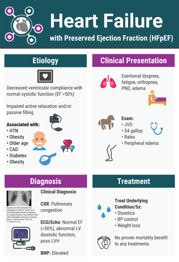 heart failure – ชวนอ่าน